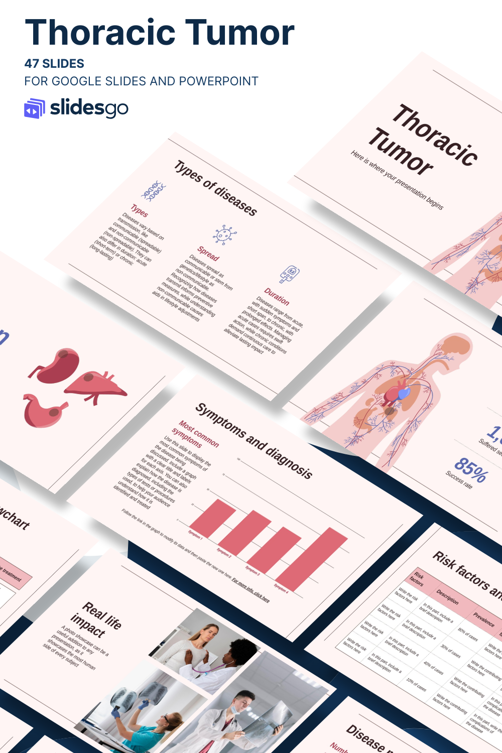 Thoracic Tumor Presentation