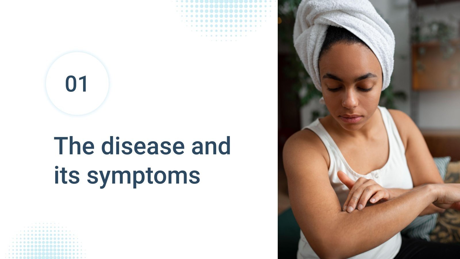 Scleroderma Presentation