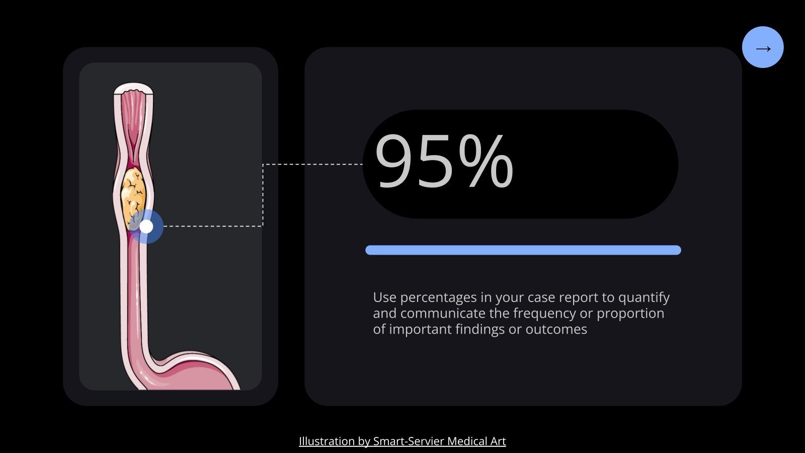 Digestive System Case Study Presentation