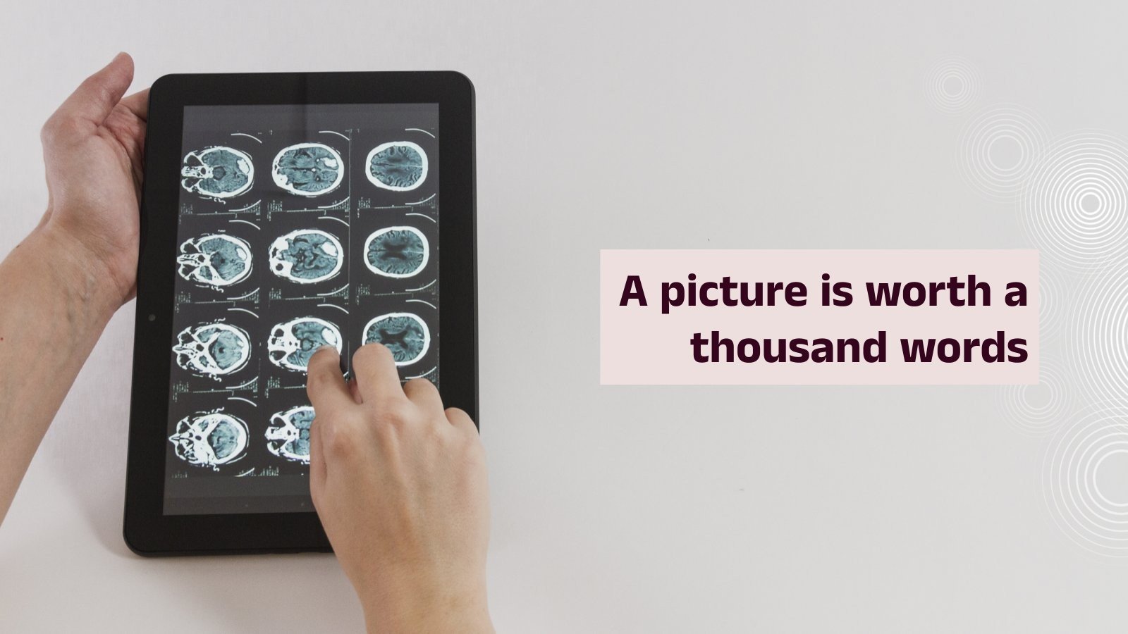 ALS & Brain Implants Breakthrough | Google Slides & PowerPoint