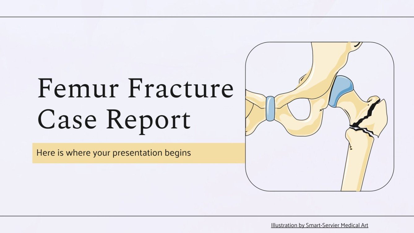 Femur Fracture Case Report Presentation