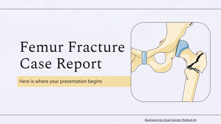 Femur Fracture Case Report Presentation