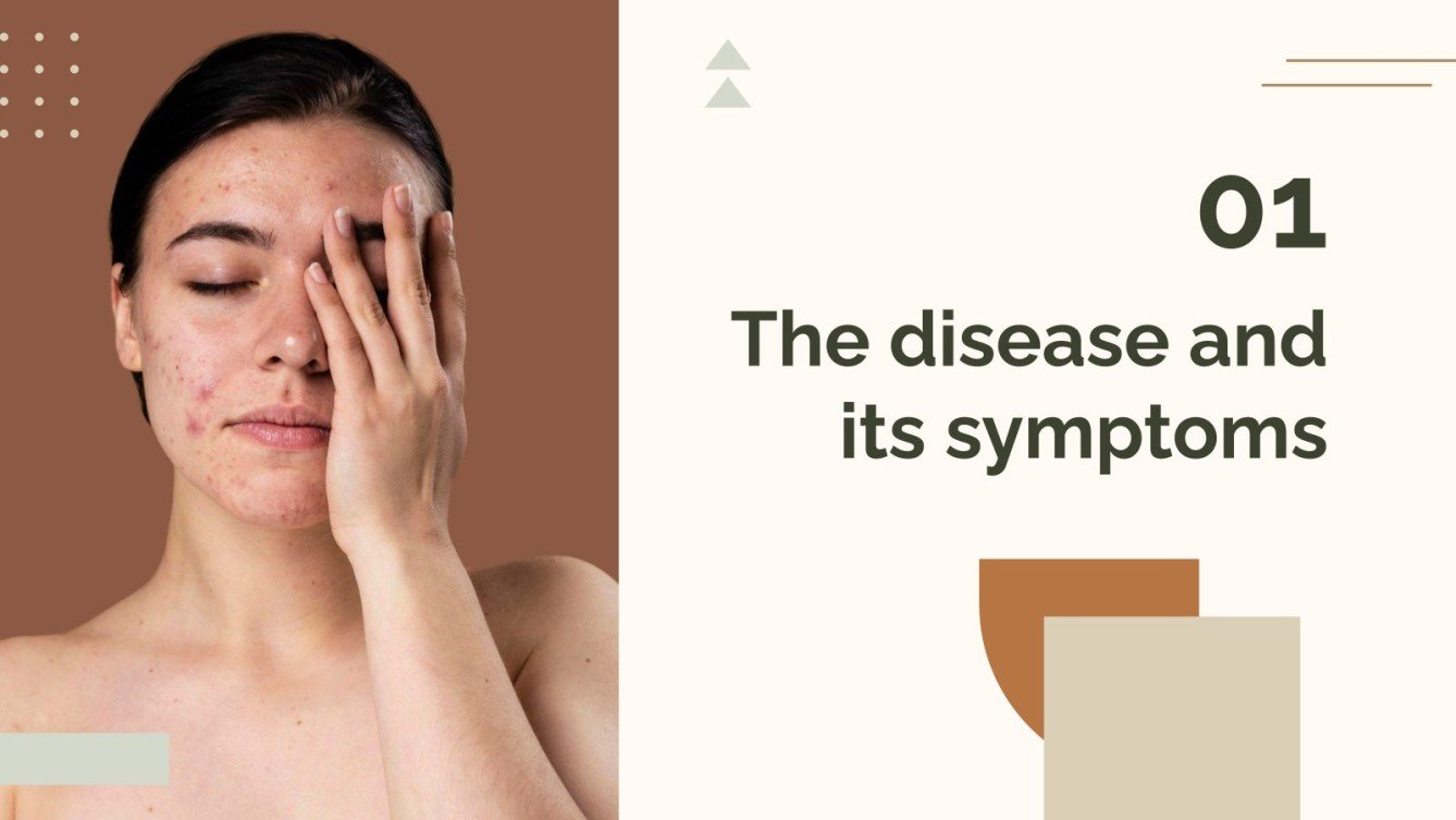 Human Skin Disease: Acne Presentation