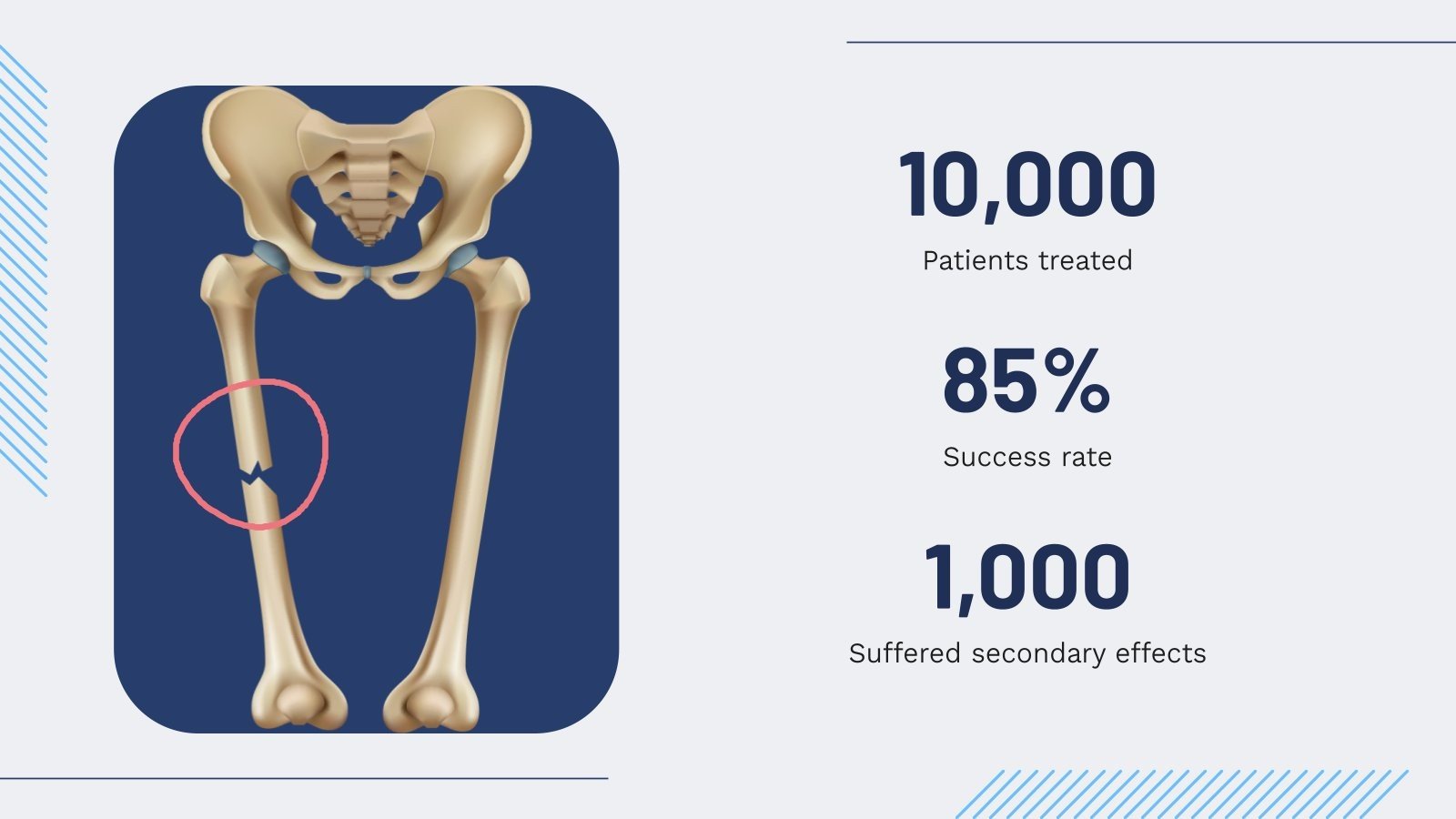 Femur Fracture Presentation