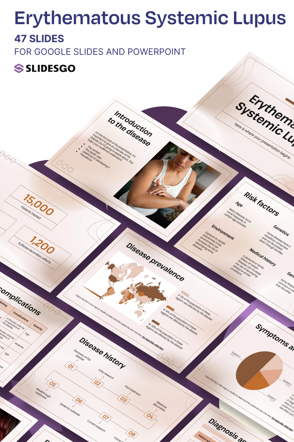 Erythematous Systemic Lupus Presentation