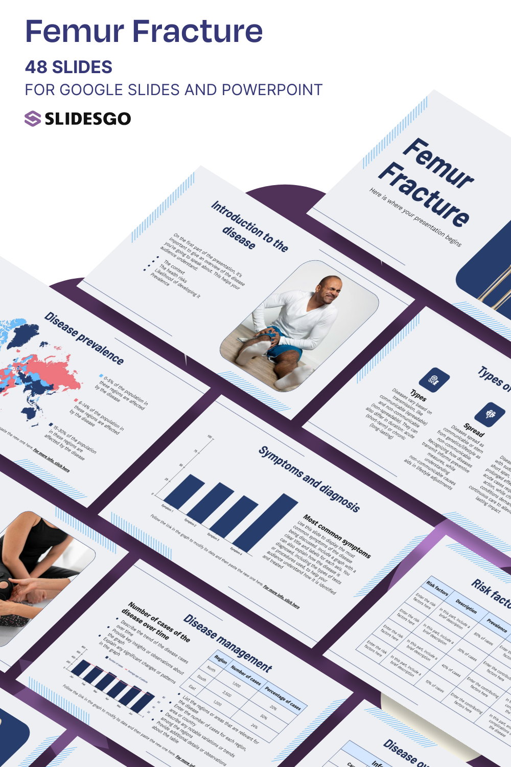 Femur Fracture Presentation