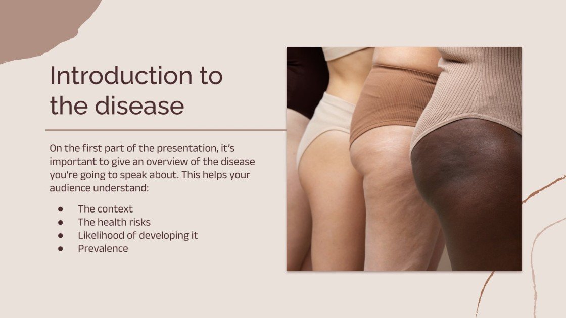 Cellulite Symptoms and Causes Presentation
