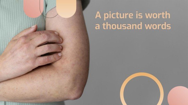 Integumentary System for Medical Students | Google Slides & PPT