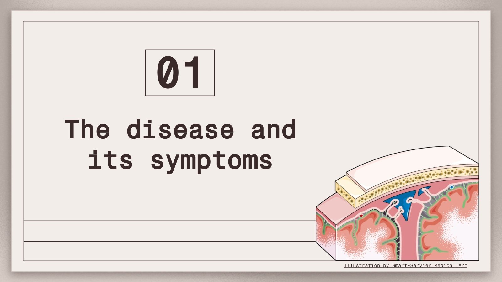 Infectious Disease: Meningitis Presentation