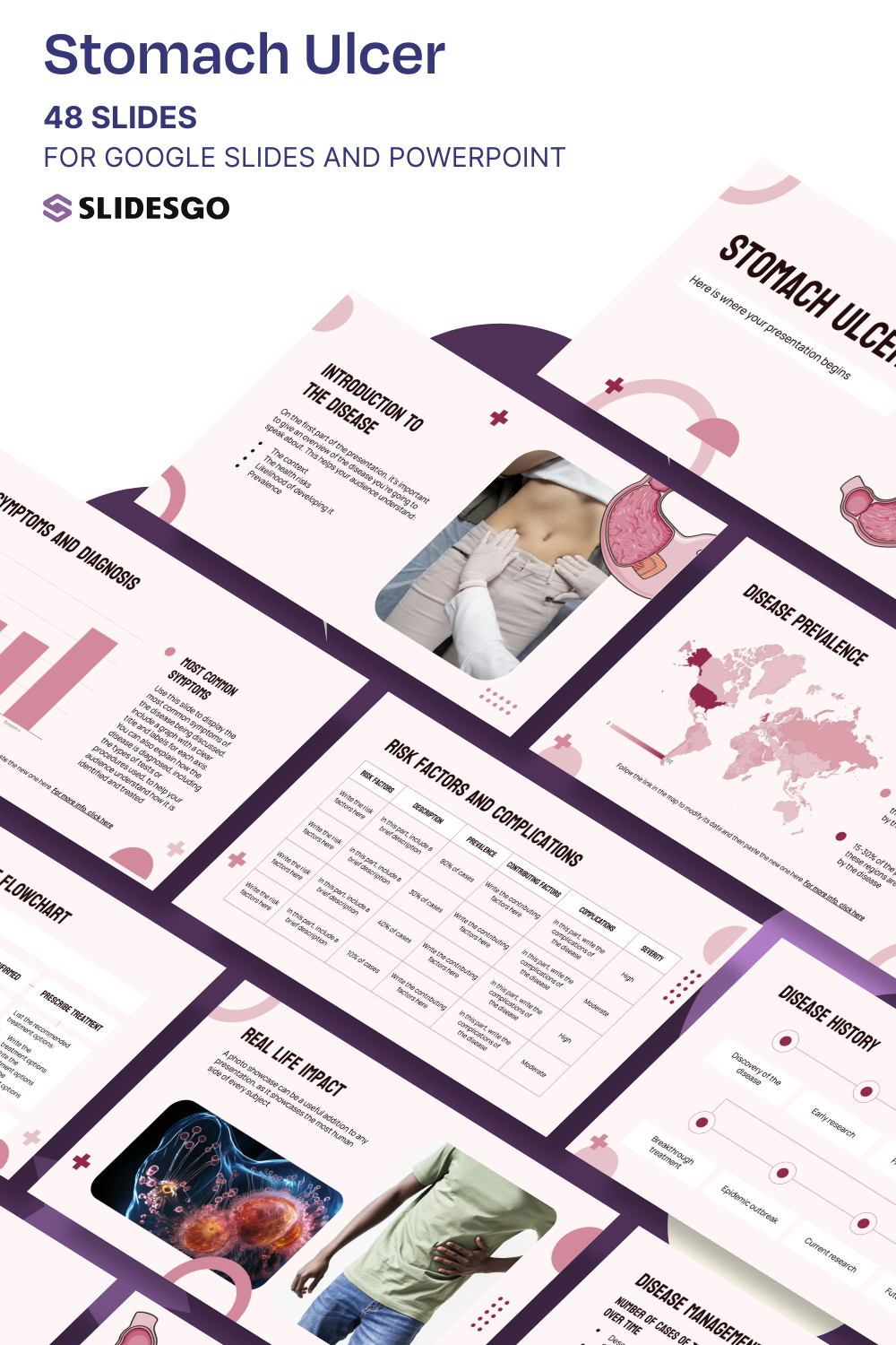 Stomach Ulcer Presentation