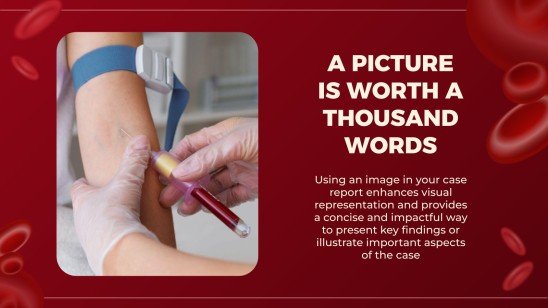 Idiopathic Aplastic Anemia Case Report Presentation