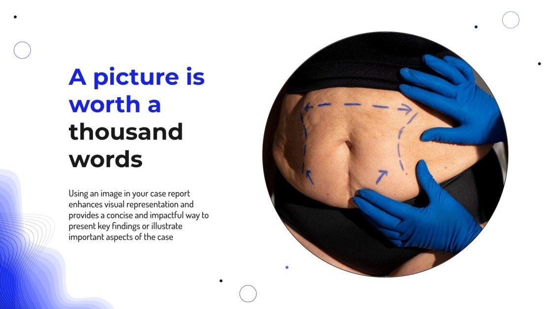 Bariatric Surgery Case Study Presentation