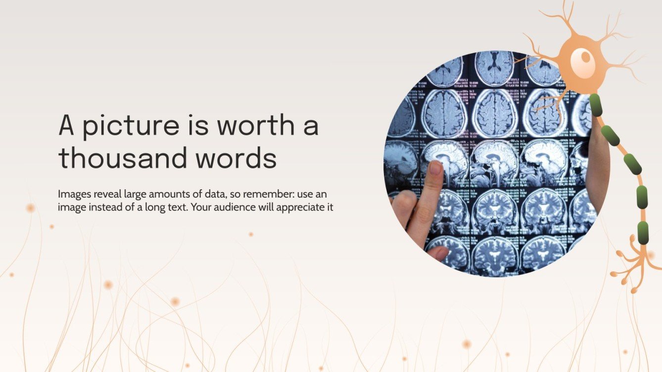 Pediatric Multiple Sclerosis Clinical Case Presentation