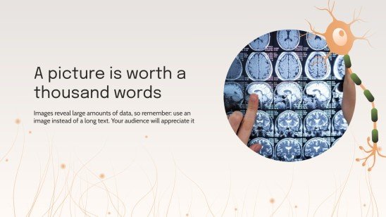 Pediatric Multiple Sclerosis Clinical Case Presentation