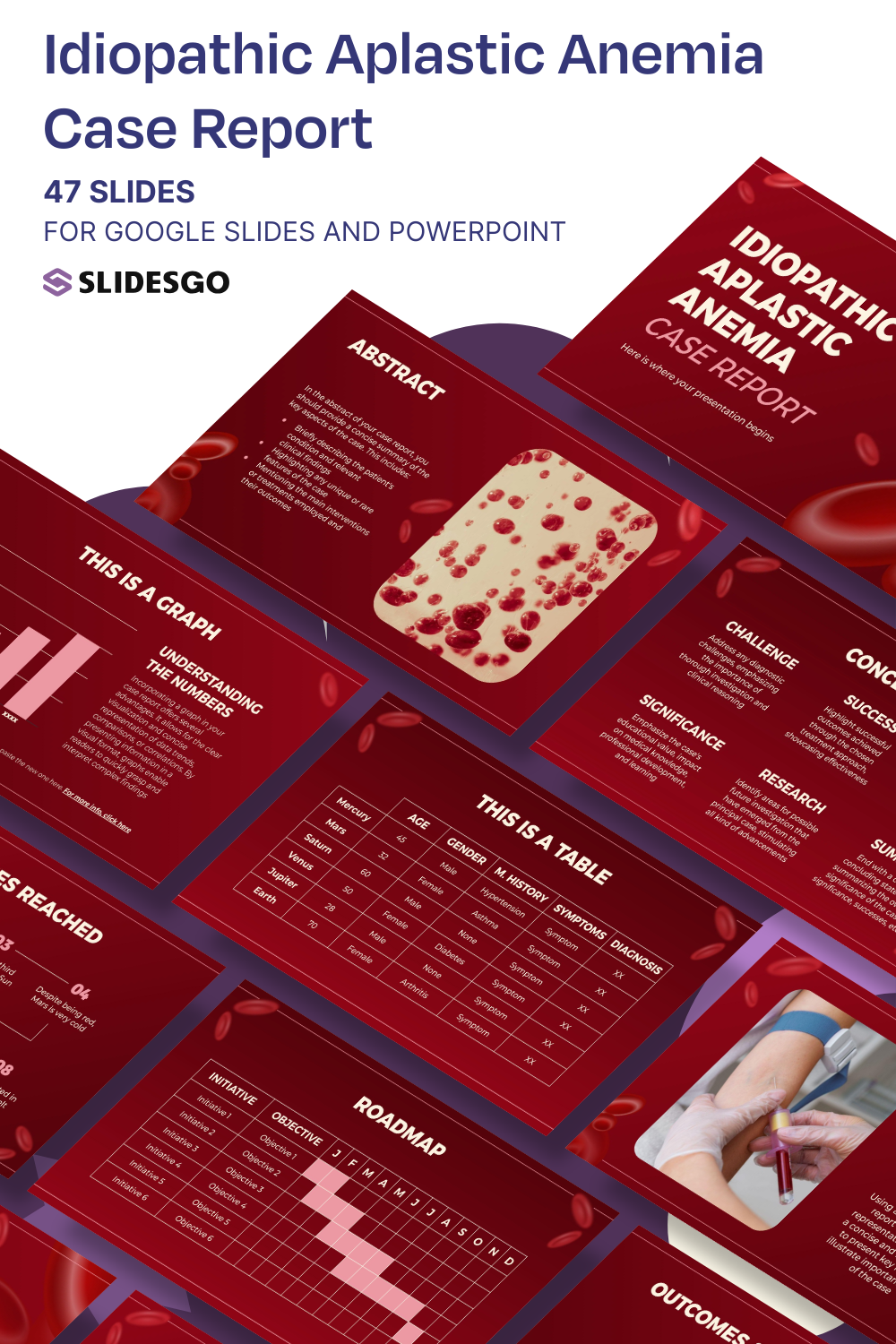 Idiopathic Aplastic Anemia Case Report Presentation