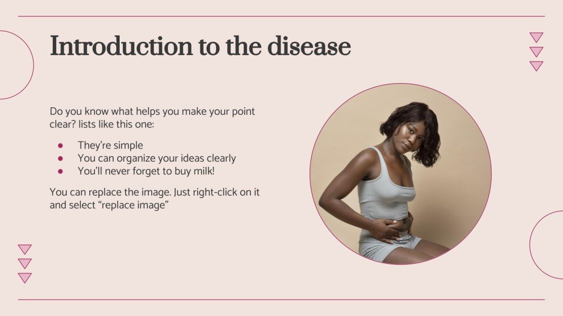 Aparato reproductor femenino: prolapso del útero