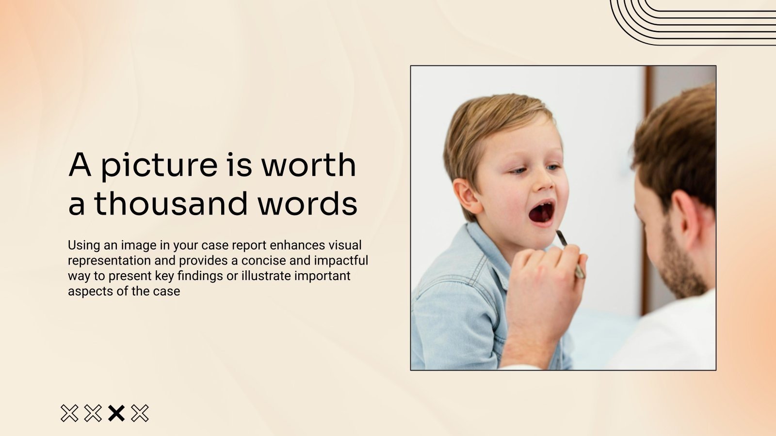 Tonsillitis Case Report Presentation