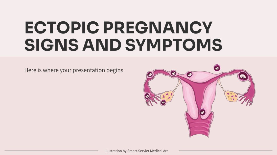 Ectopic Pregnancy Signs and Symptoms Presentation