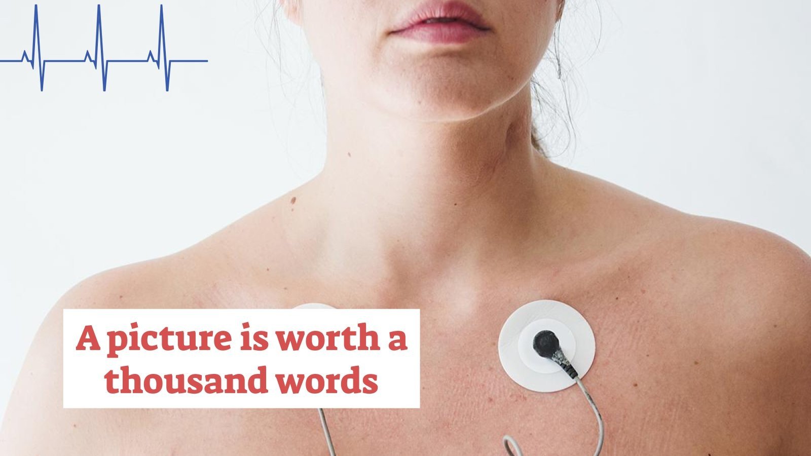 Electrocardiogram (EKG) Minitheme Presentation