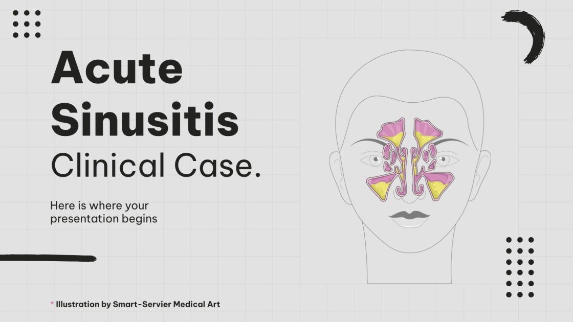 Acute Sinusitis Clinical Case Presentation