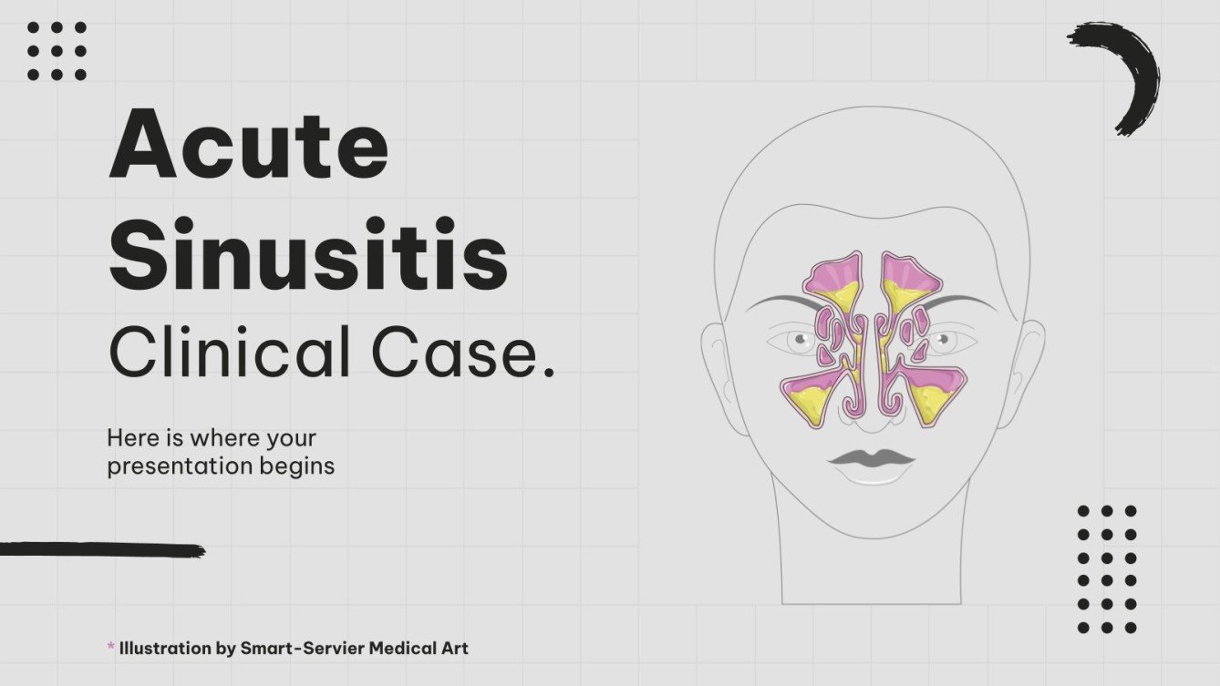 Acute Sinusitis Clinical Case Presentation