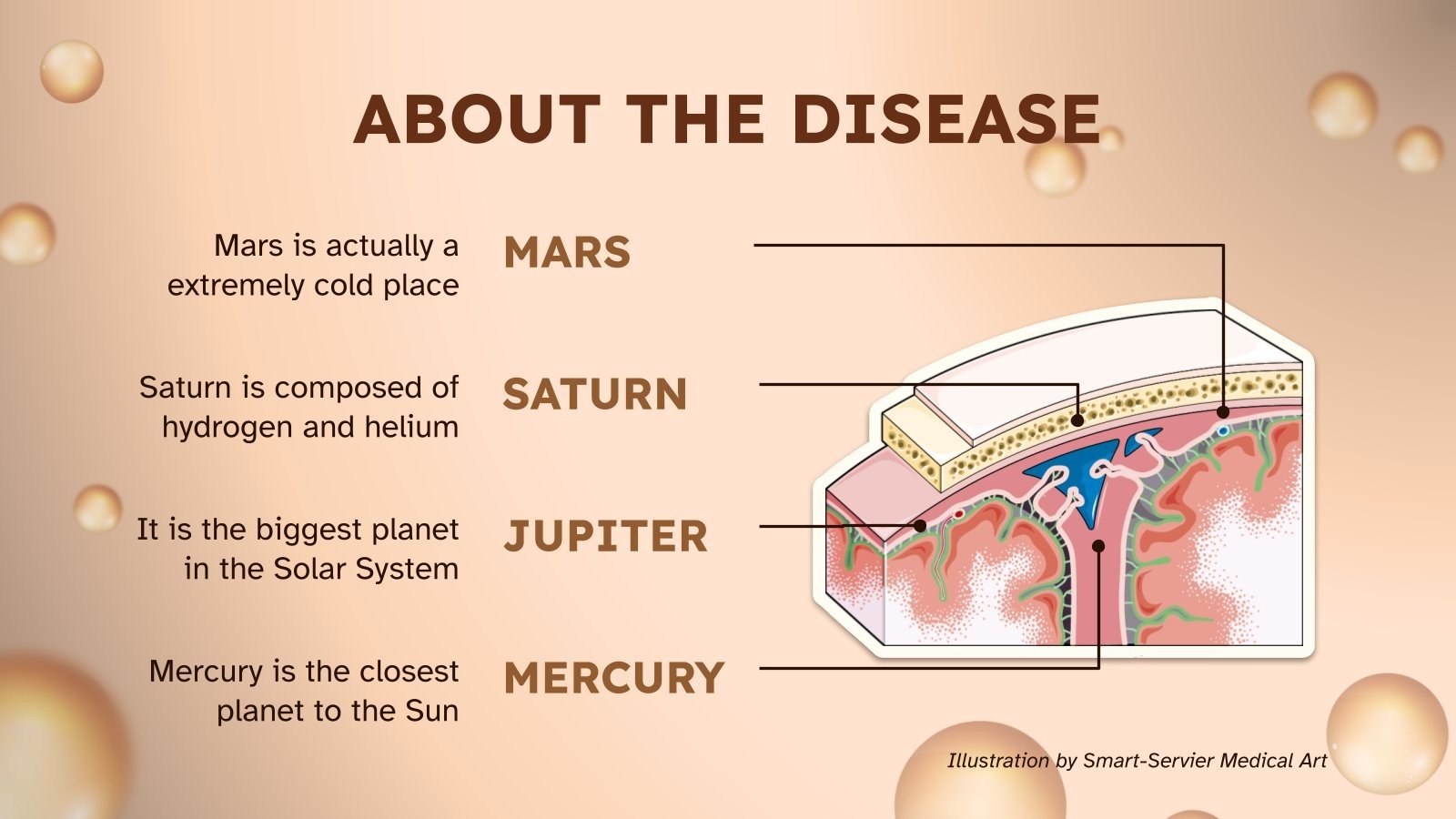 Meningococcal Disease Presentation