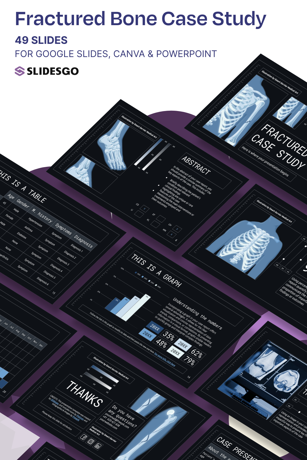 Fractured Bone Case Study Presentation