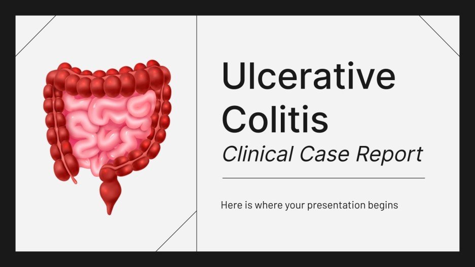 Ulcerative Colitis Clinical Case Report Presentation
