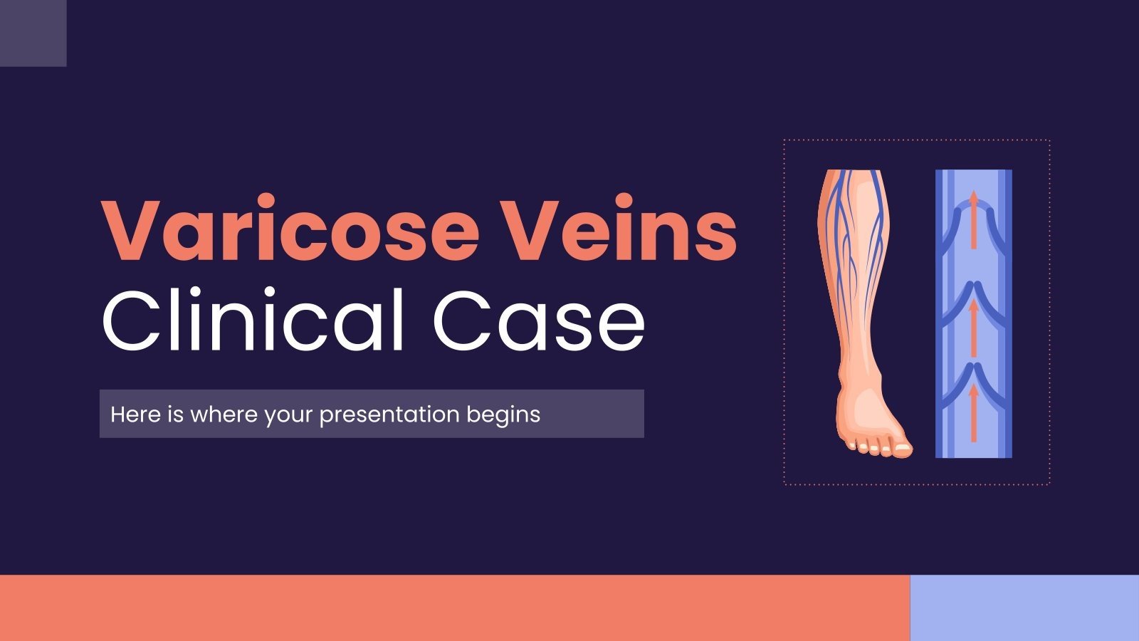 Varicose Veins Clinical Case Presentation