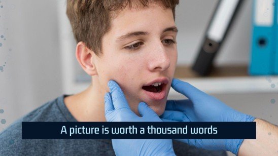 Anatomy Lesson for Middle School: Jaw Presentation