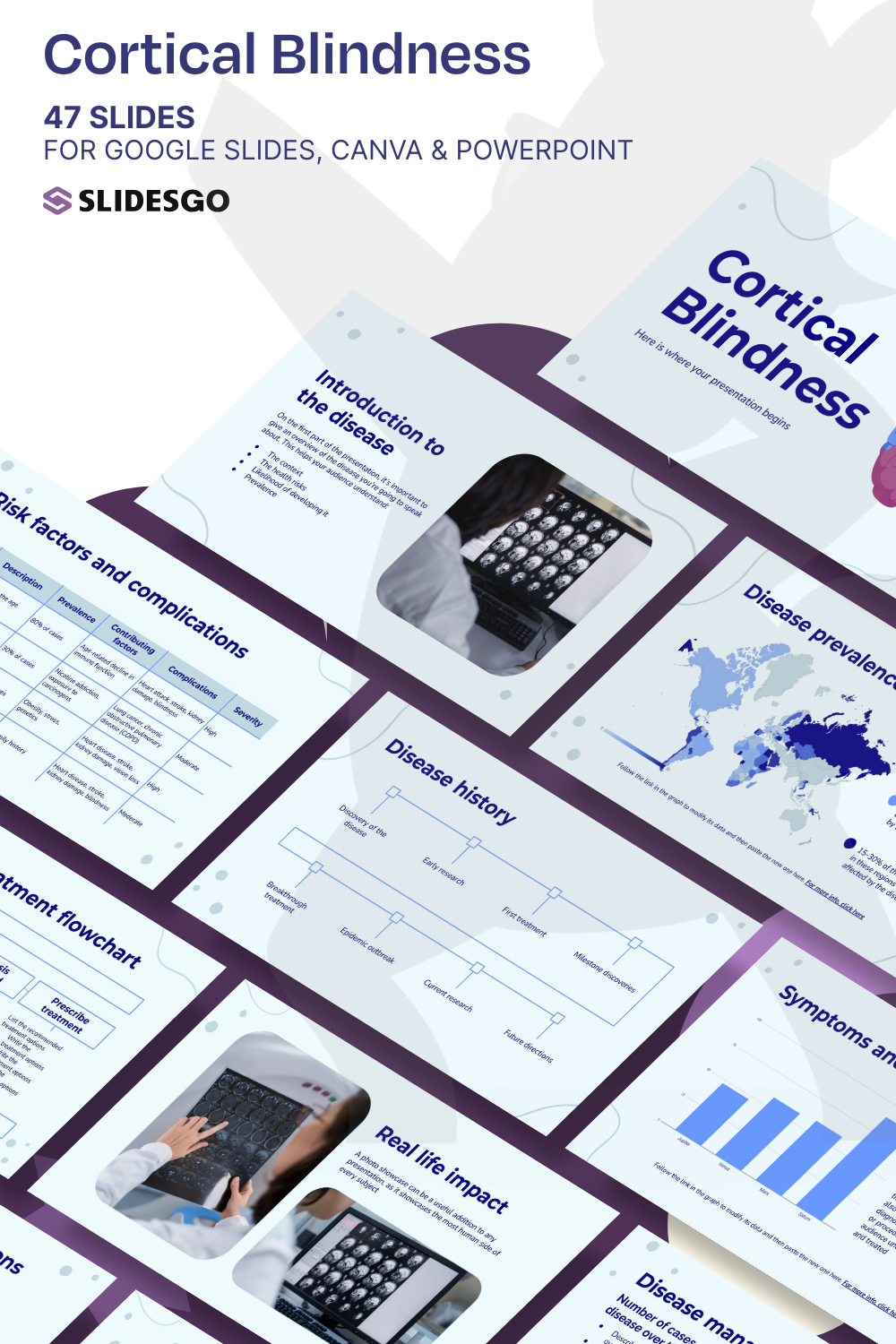 Cortical Blindness Presentation