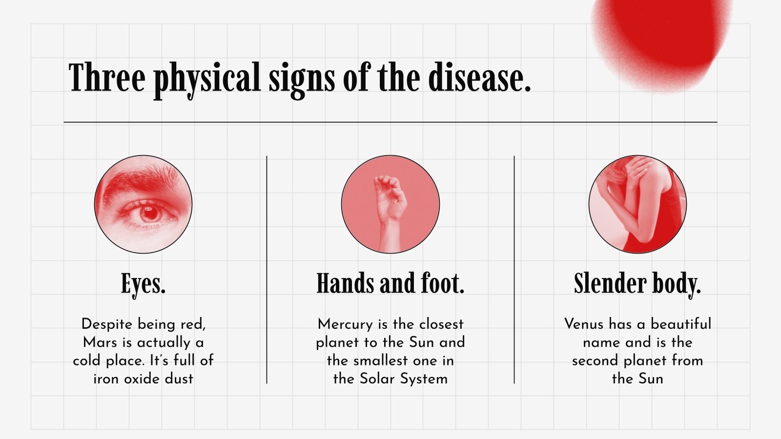Marfan Syndrome Minitheme Presentation