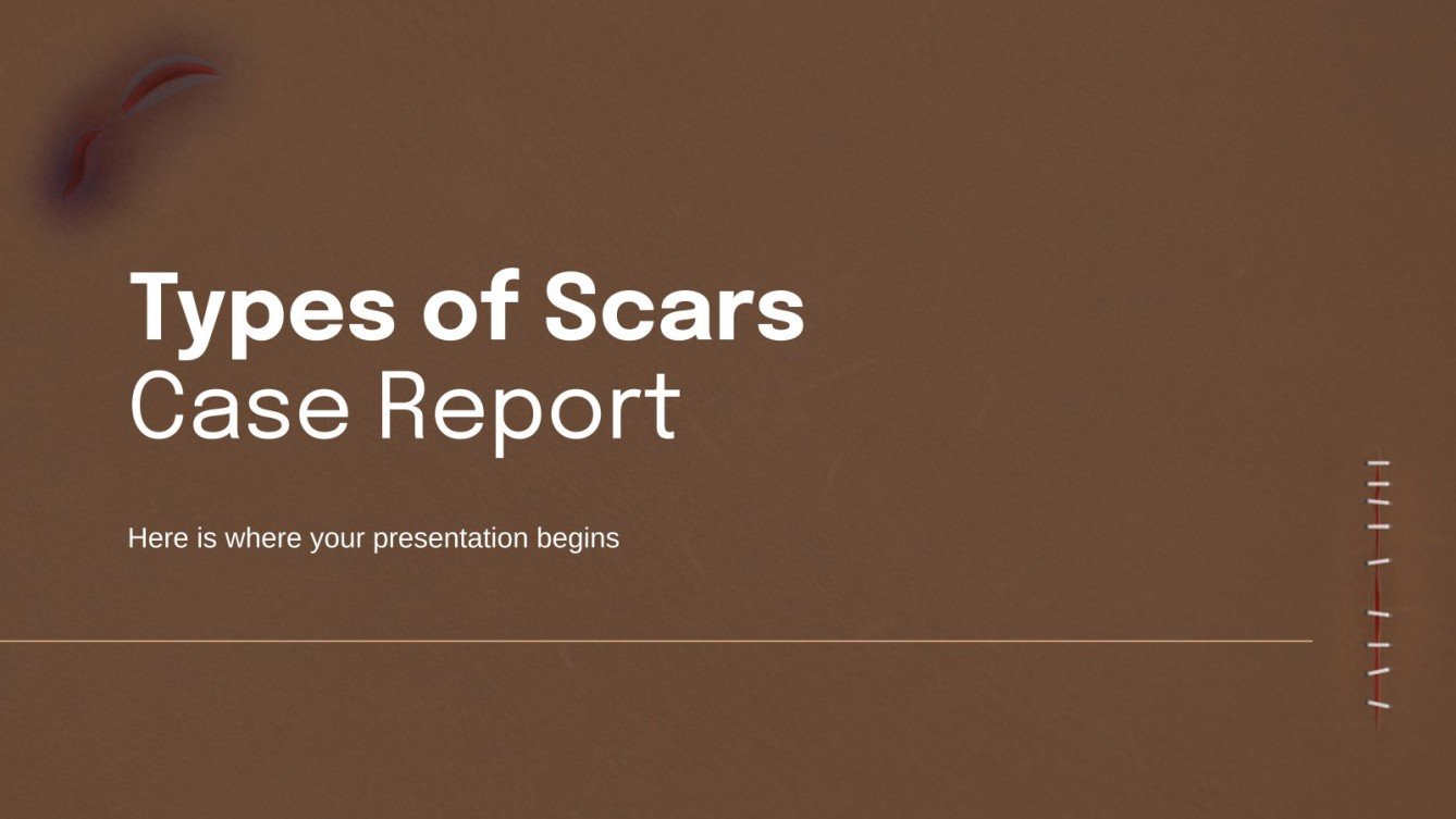 Free Case Report Google Slides and PowerPoint templates