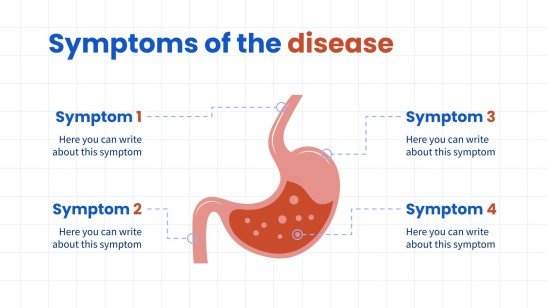 Rare Diseases: Achalasia Presentation