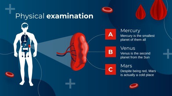 Rare Diseases Clinical Cases: Banti’s Syndrome Presentation