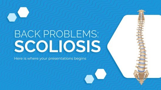 Back Problems: Scoliosis Presentation