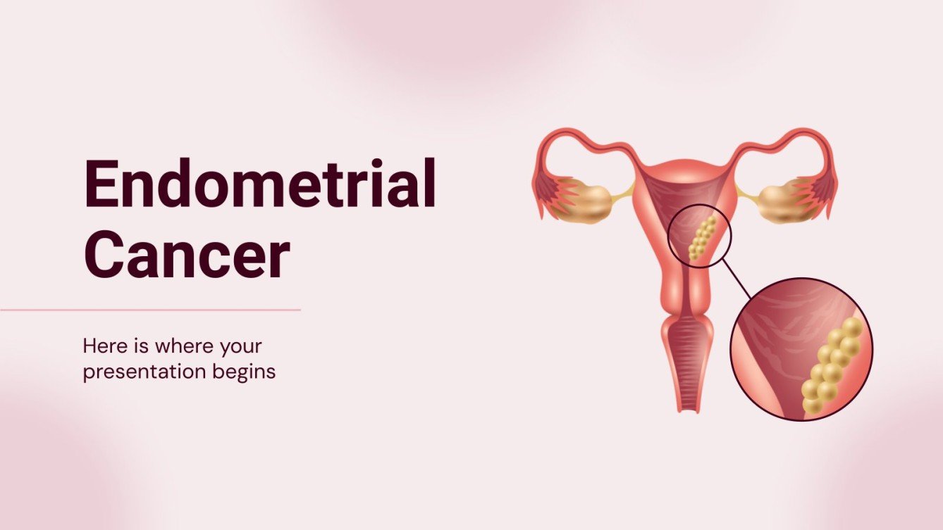 Endometrial Cancer Presentation