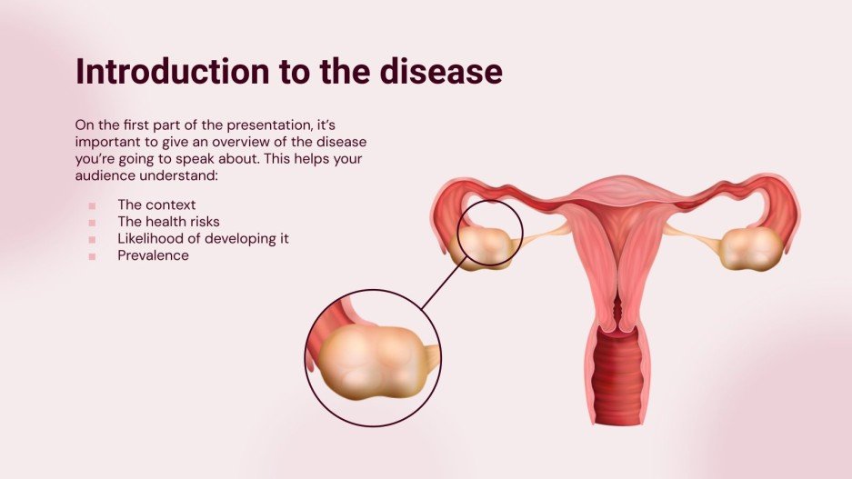 Endometrial Cancer Presentation