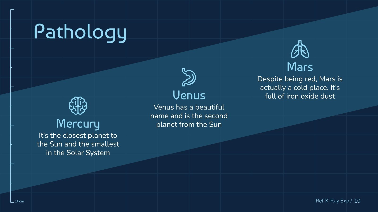 X-Ray Style Disease | Google Slides and PowerPoint