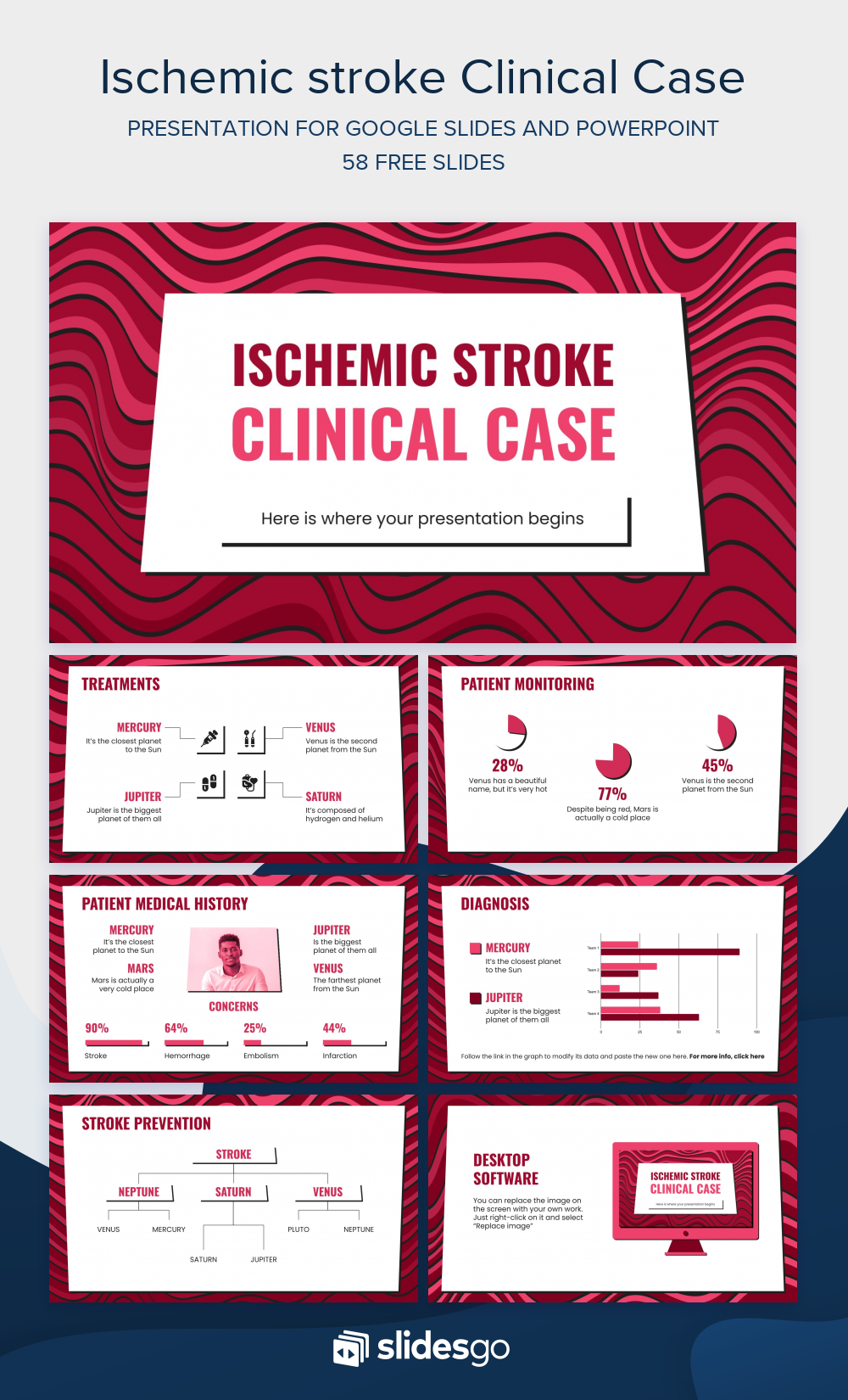 Ischemic Stroke Clinical Case | Google Slides & PowerPoint