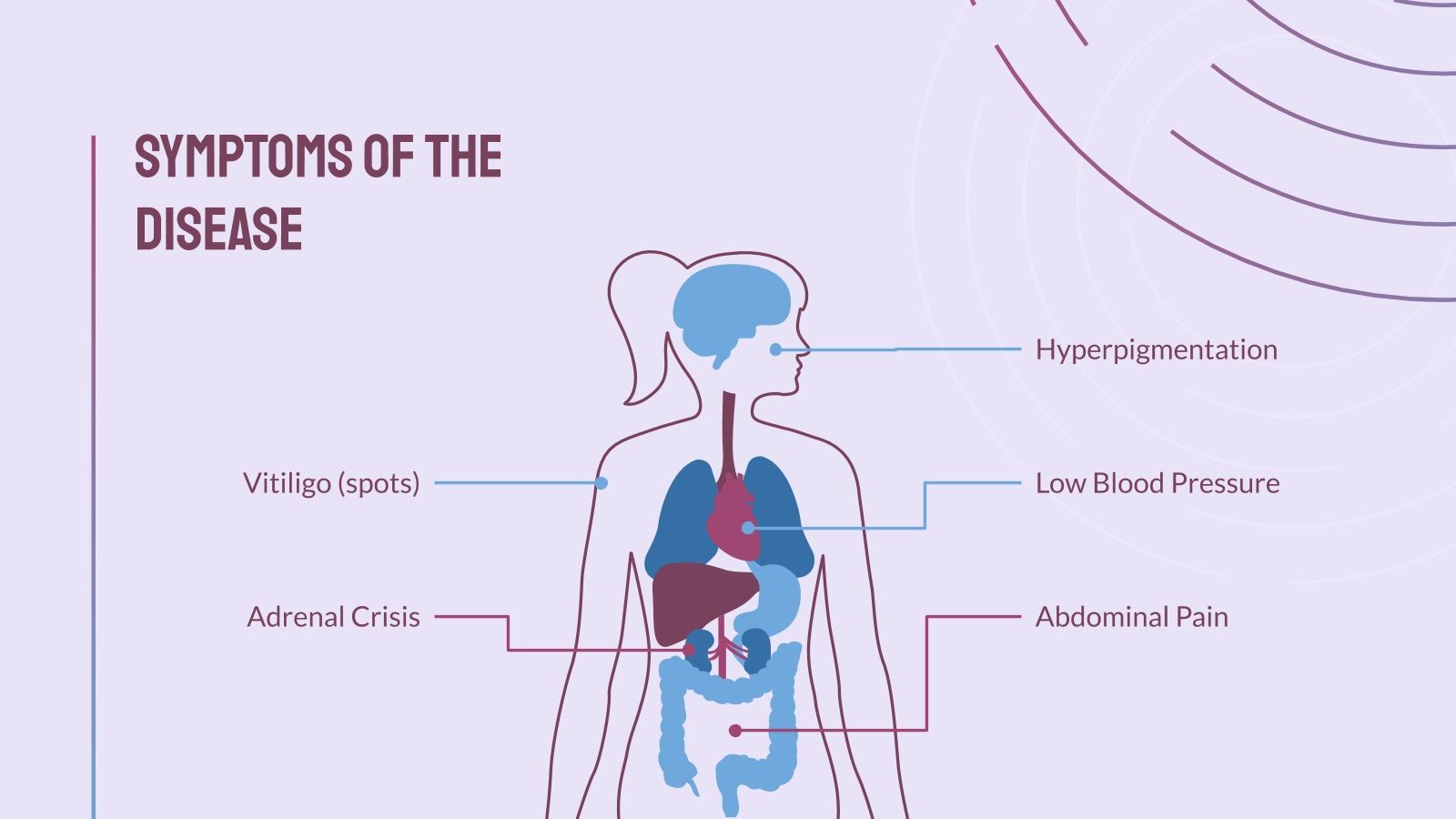 Addison's Disease Google Slides theme and PowerPoint template